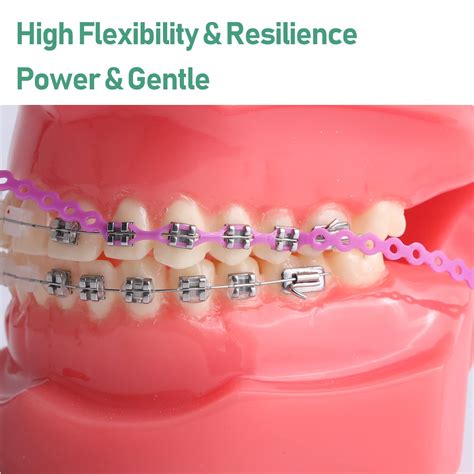 Real Life Experiences: Living With Power Chains - Power Chains Braces